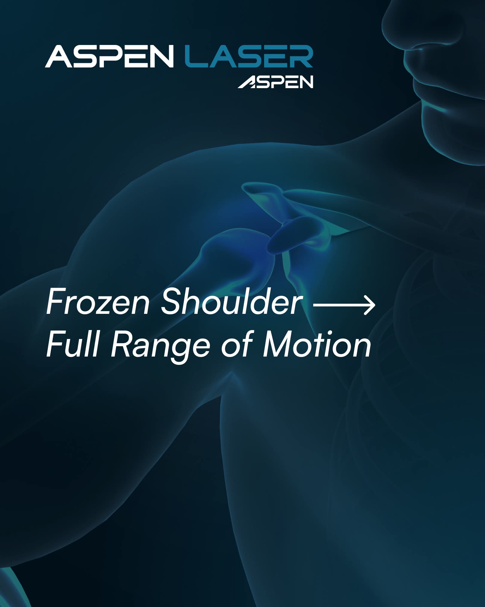 Aspen Laser Therapy Palm Harbor FL - Pain Relief | Cryogenix